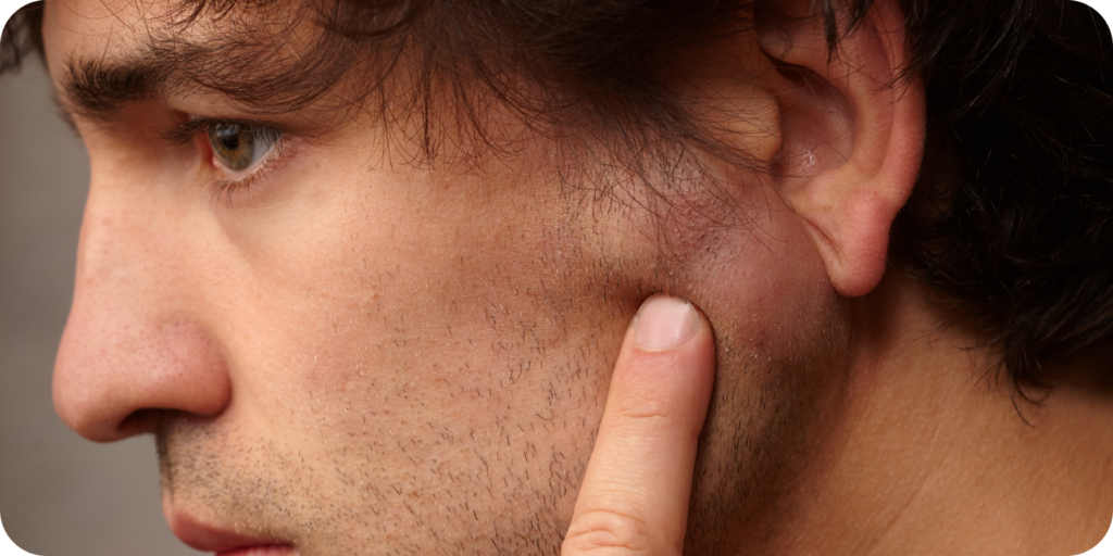 Facial Trauma & Reconstruction